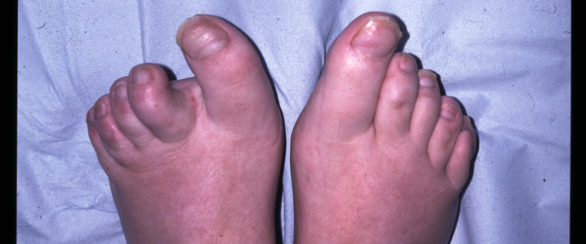 Types-of-foot-conditions